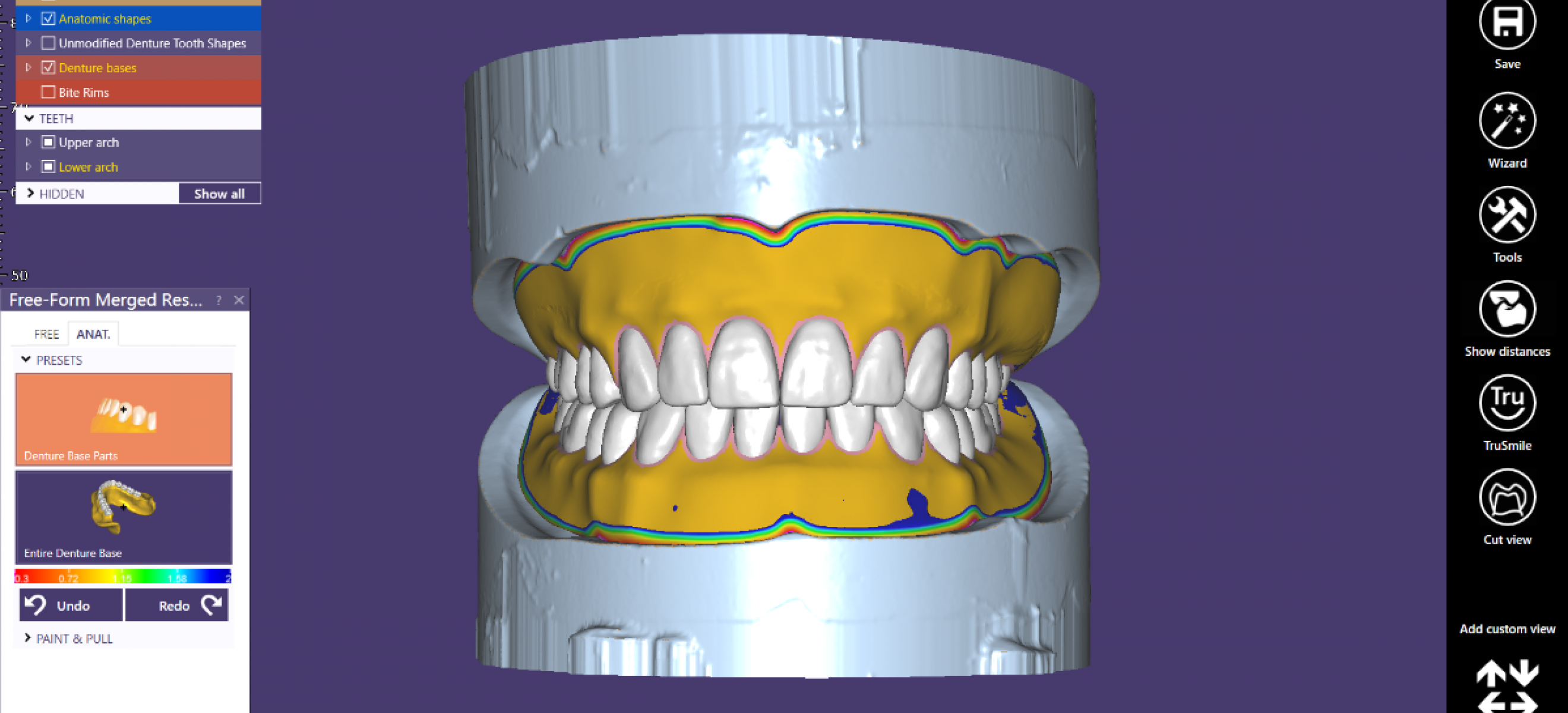 Smriirkers CAD Dental Design Services from India to Worlwide