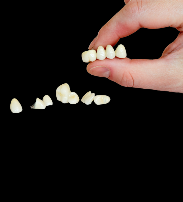 Premium Dental Lab Services in Delhi NCR | Advanced CAD/CAM & DMLS ...