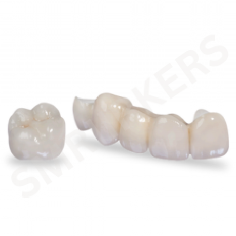 Full Contour Zirconia Crowns