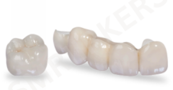 Full Contour Zirconia Crowns