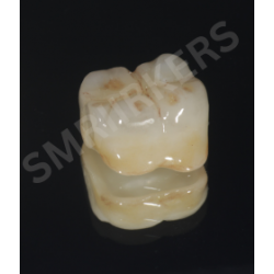 Lithium Disilicate Crowns